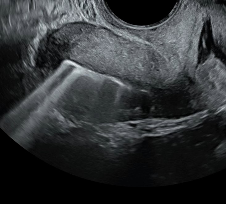 L'HyFoSy - Procreo la Soie